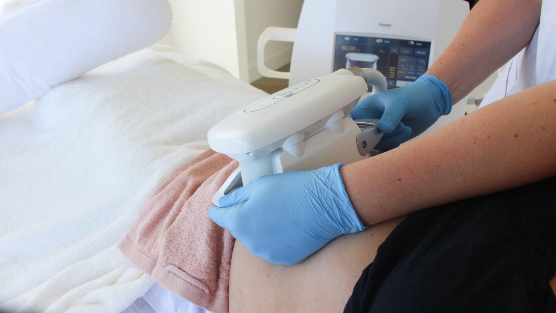Cryolipolyse | Vet bevriezen met de beste apparatuur